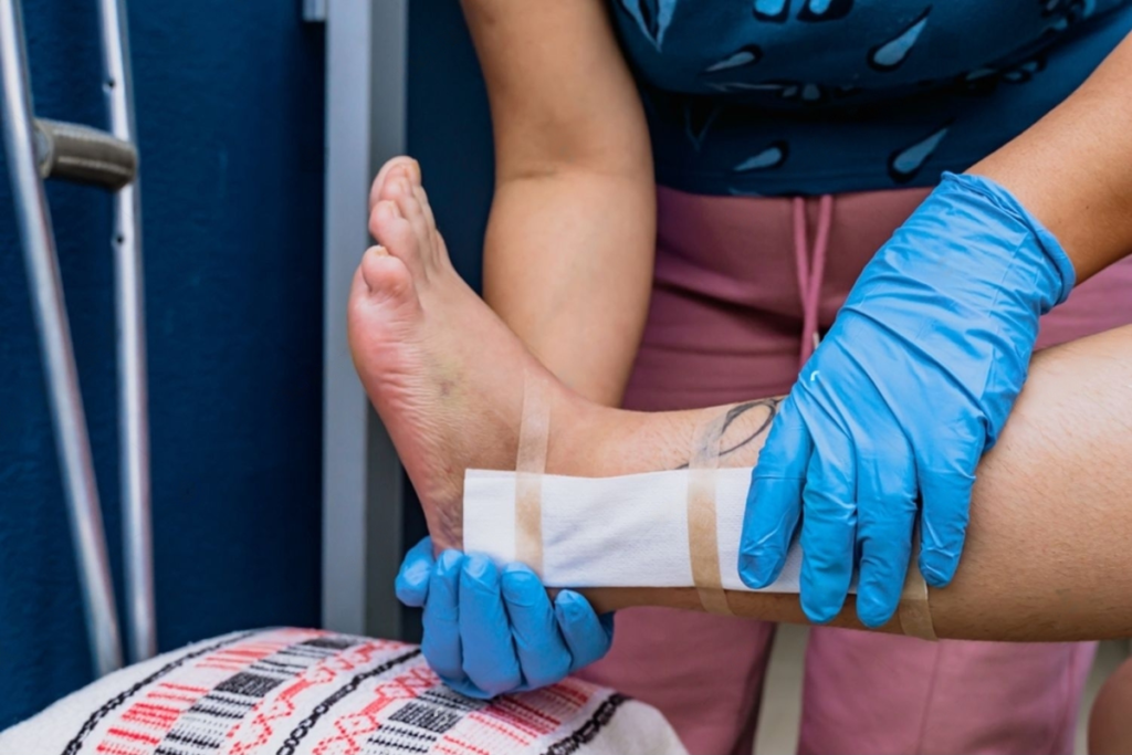 Comprehensive Guide to Ankle Fracture Surgery in Quezon City ...